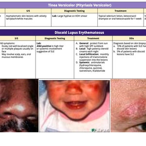 Dermatology Guide Perfectly Organized for Nursing Nclex, PA Pance, and ...