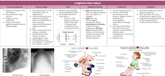 Cardiology Guide Perfectly Organized for Nursing Nclex PA - Etsy