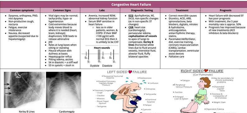 Cardiology Guide Perfectly Organized for Nursing Nclex, PA Pance, and ...