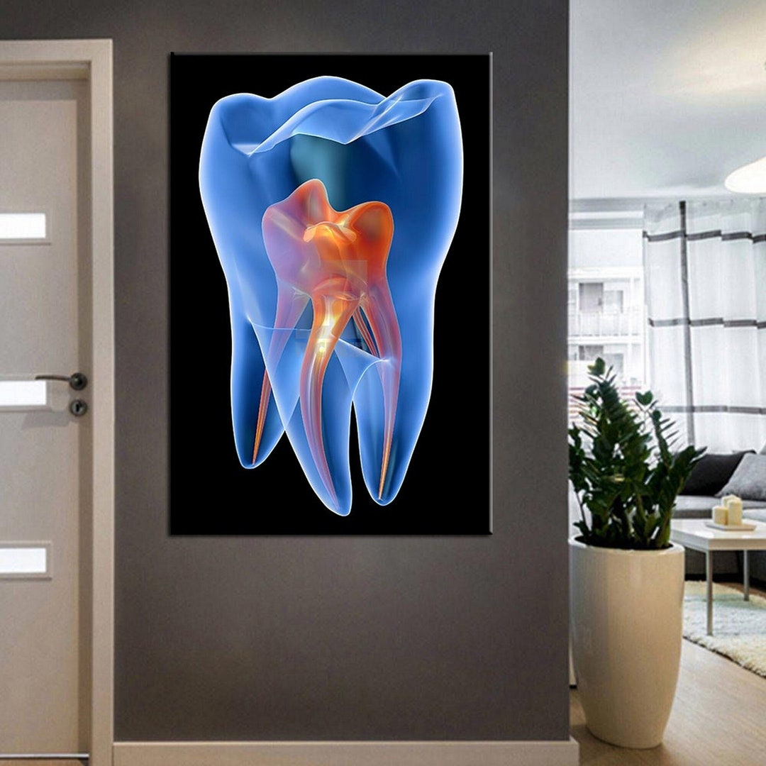 X-ray Molar Tooth, Dental Art, Dentist Art, Dental Clinic Deco Canvas ...