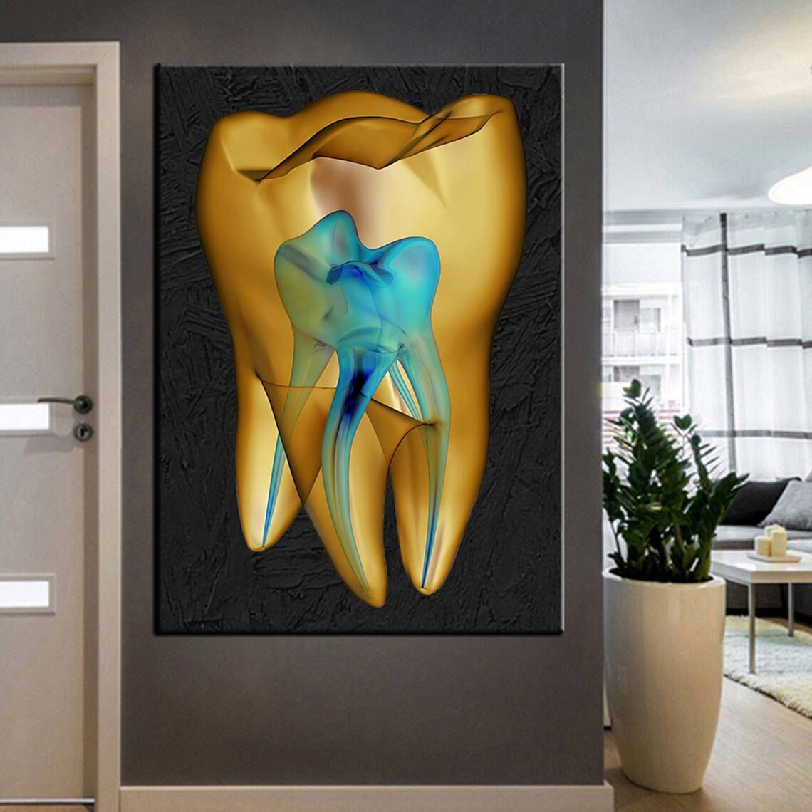X-ray Molar Tooth Dental Art Dentist Art Dental Clinic Deco - Etsy