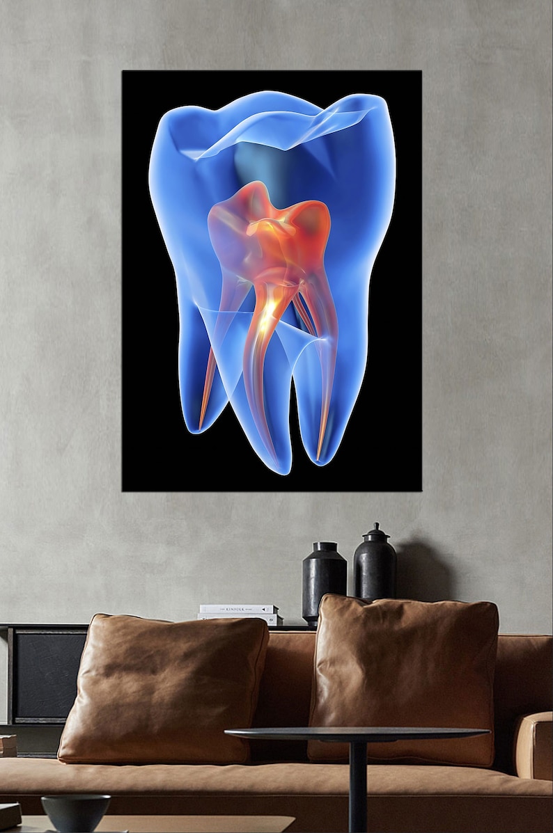 X-ray Molar Tooth Dental Art Dentist Art Dental Clinic Deco - Etsy
