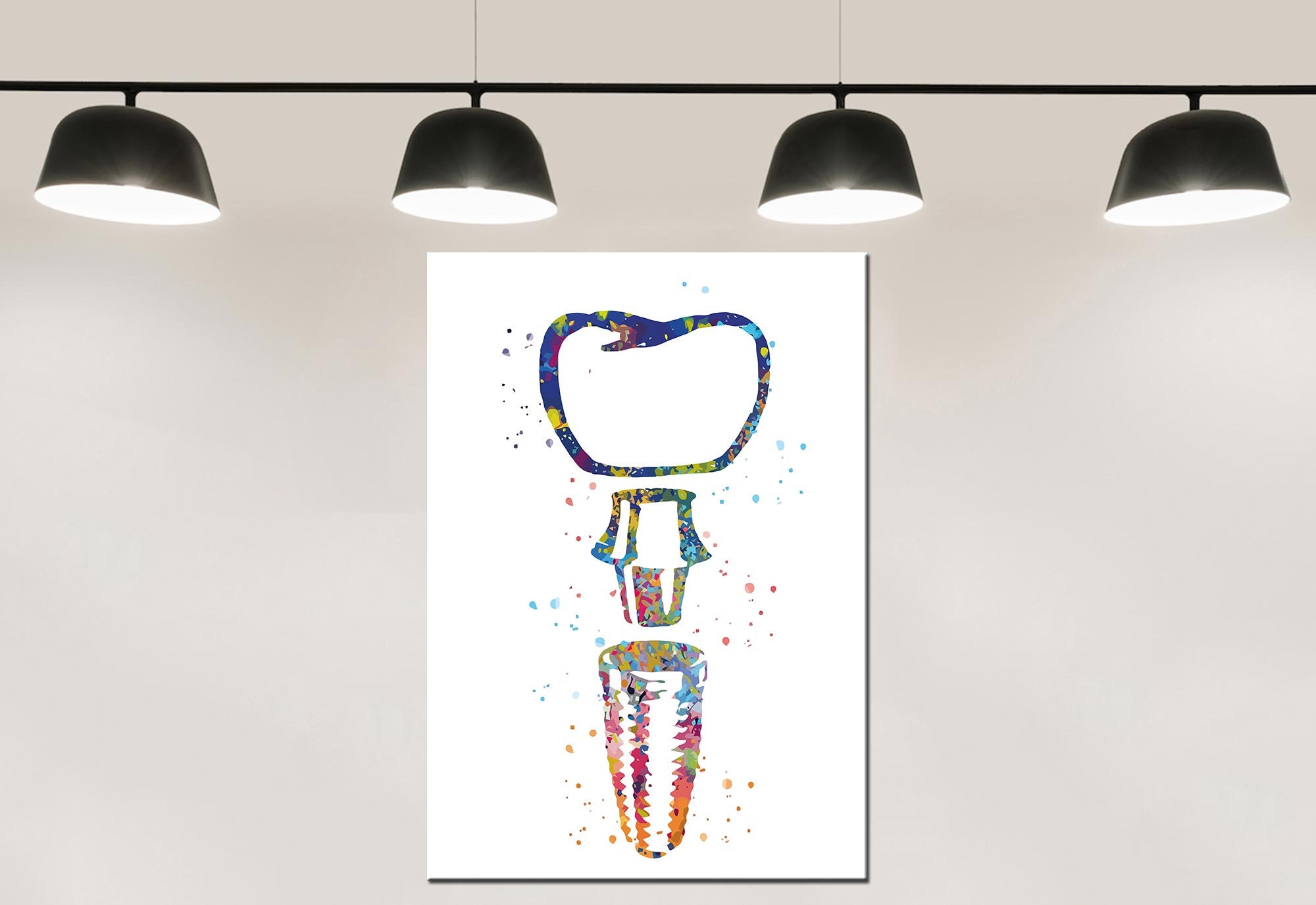 Dentistry Wall Art Dentist Art Implant Tooth Wall Art - Etsy
