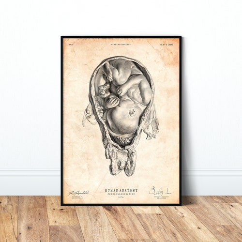 Pregnancy Print Baby Art Expecting Mom Gift Fetus in Womb - Etsy