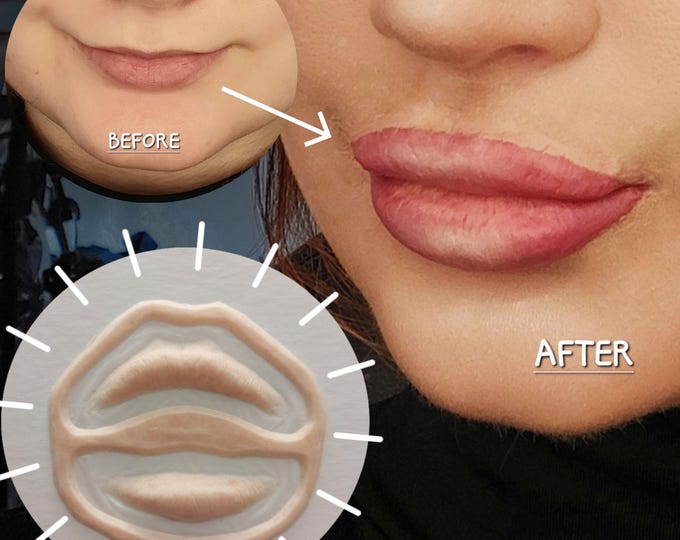 Lip Prosthetics/ Enhanced Lips/ Botox Lips/ False Lips/ Doll Lips/ Lip ...
