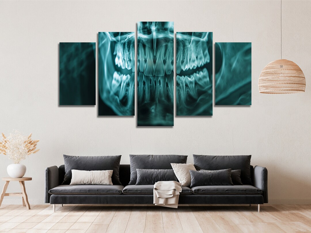 Dental Teeth X-rays Panoramic Canvas Wall Art, Large Framed Canvas Wall ...