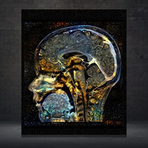 Brain Anatomy Art Ready to Hang Canvas Radiology Wall Art - Etsy