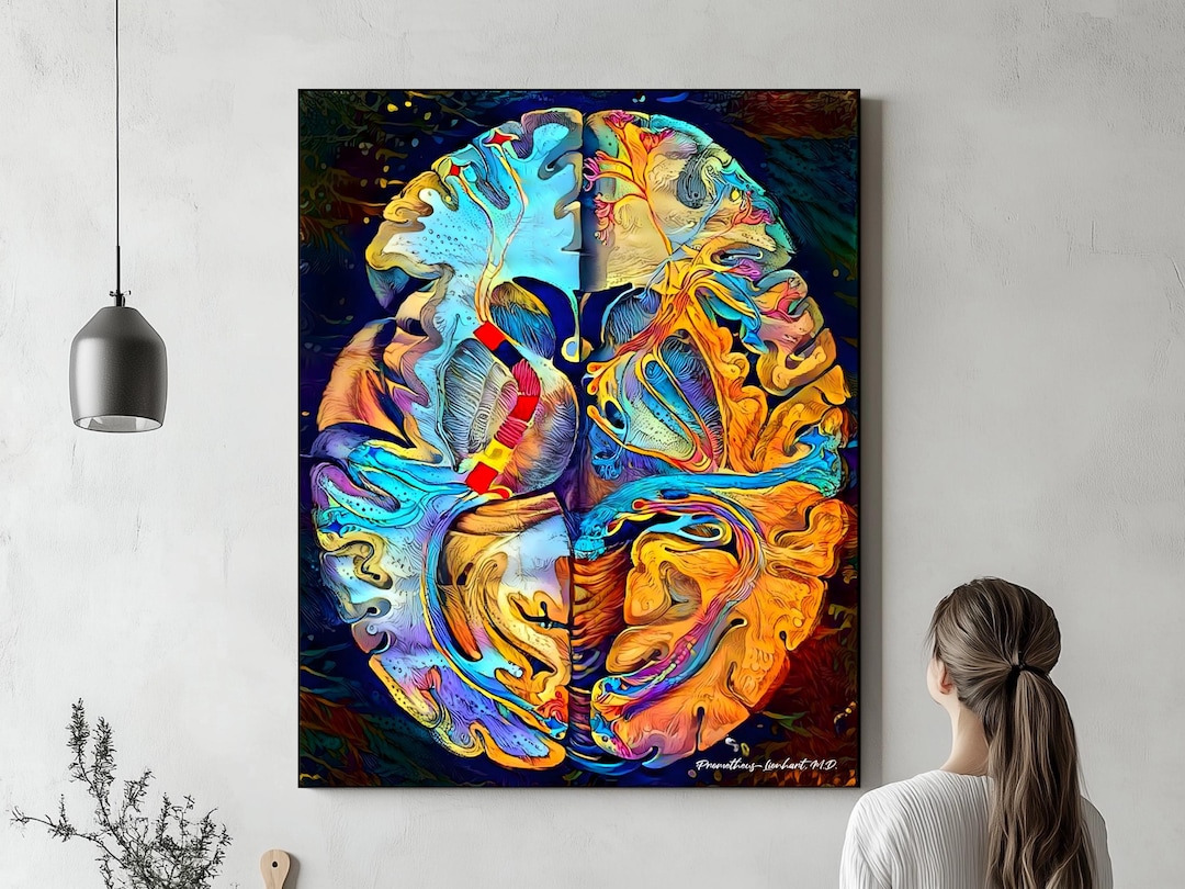Brain Anatomy Art, Canvas or Acrylic, “alba Materia Cerebri” Doctors ...