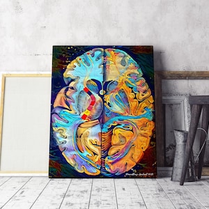 Brain Anatomy Art, Canvas or Acrylic, “alba Materia Cerebri” Doctors ...