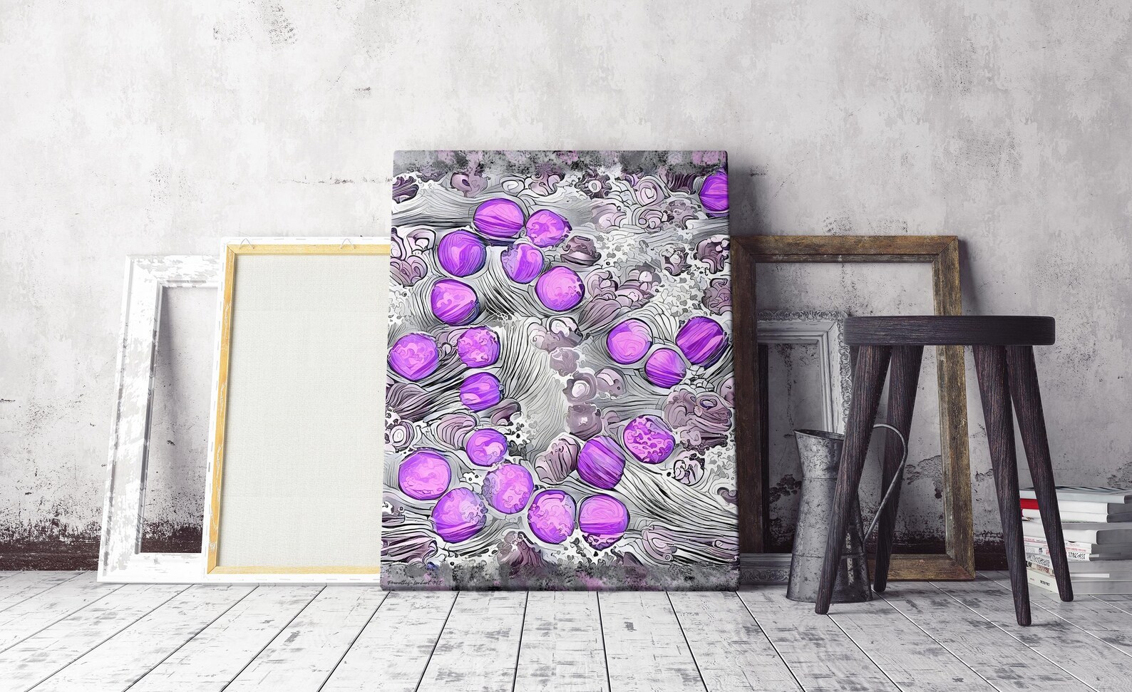 Acute Myeloid Leukemia AML, Canvas or Acrylic, “maledictus Acutis Albis ...