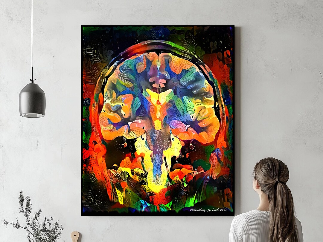 Brain Anatomy Art, Ready to Hang Canvas, Radiology Wall Art Science ...