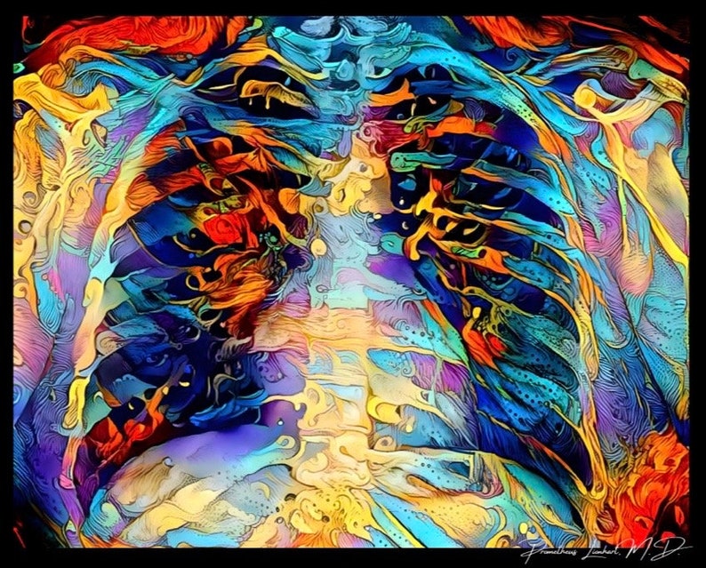 Chest Anatomy in Bright Color Canvas Anatomy Art Radiology - Etsy