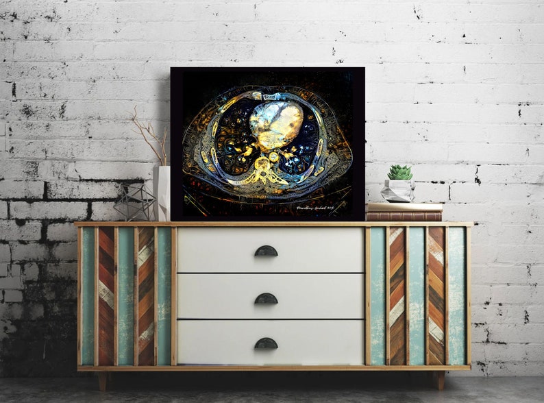 Chest Lung Pulmonary Art Canvas Anatomy Radiology Art - Etsy