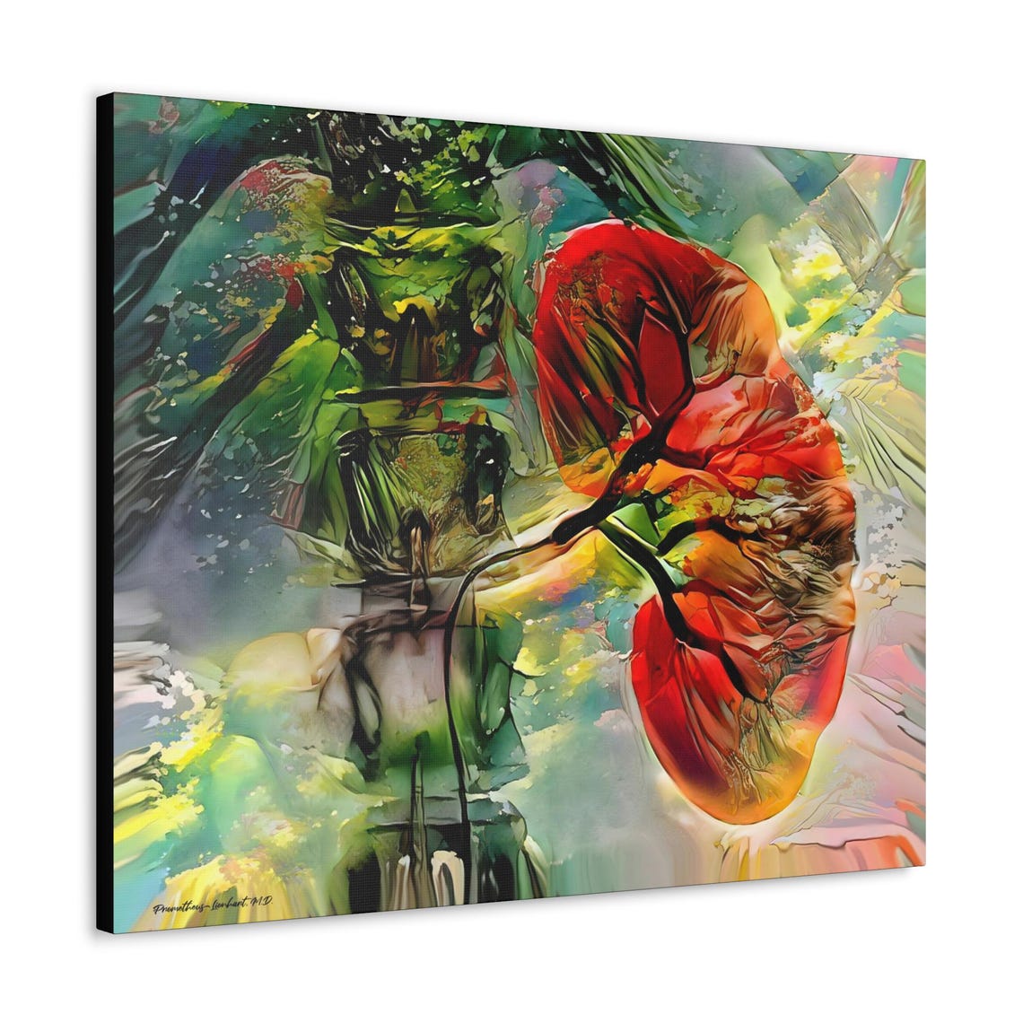 Renal Anatomy Canvas, Kidney Anatomy Art, Renal Angiogram Art, Ready to ...