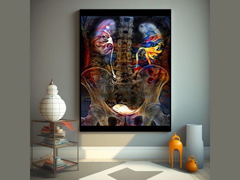 Kidney Anatomy With Drooping Lilly Canvas Anatomy Radiology - Etsy