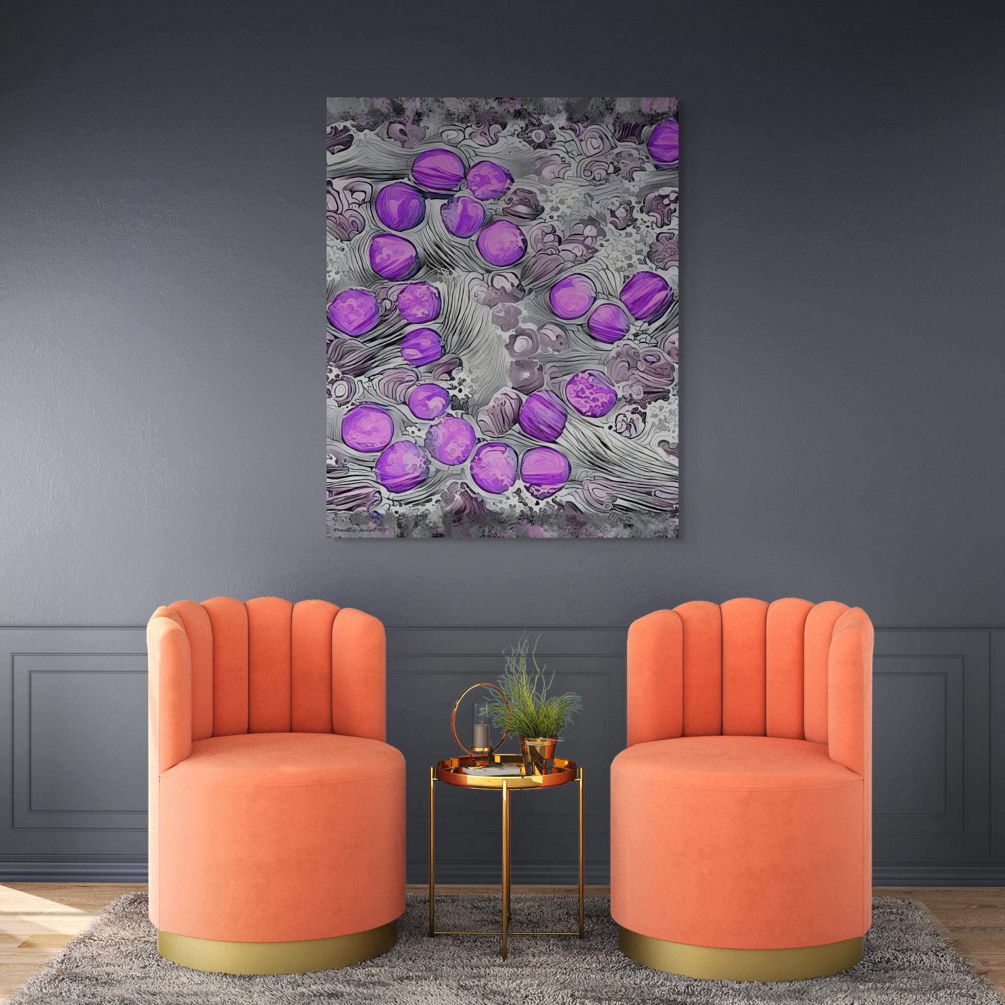 Acute Myeloid Leukemia AML, Canvas or Acrylic, “maledictus Acutis Albis ...