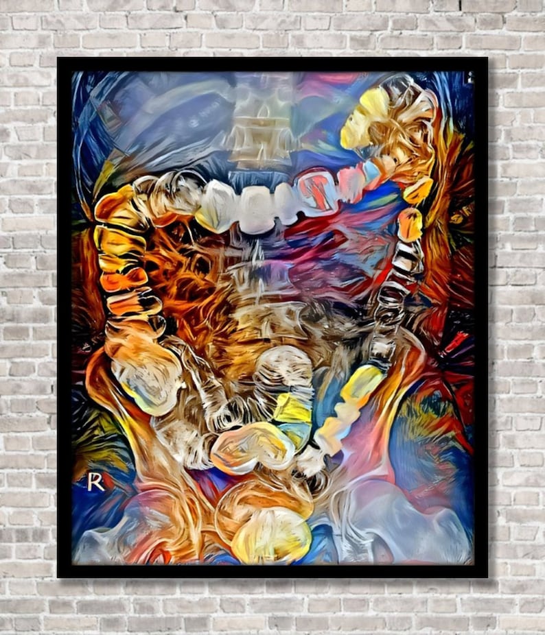Gastrointestinal Anatomy Canvas GI Radiology Wall Art - Etsy