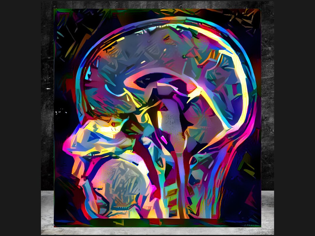Brain Anatomy in Pop Art Style Ready to Hang Canvas Bright - Etsy