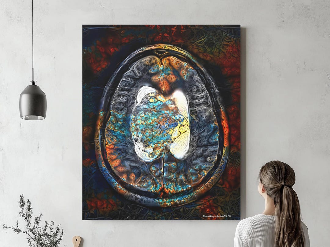Brain Tumor Art, Canvas, “central Malignantia”, Radiology Wall Art ...