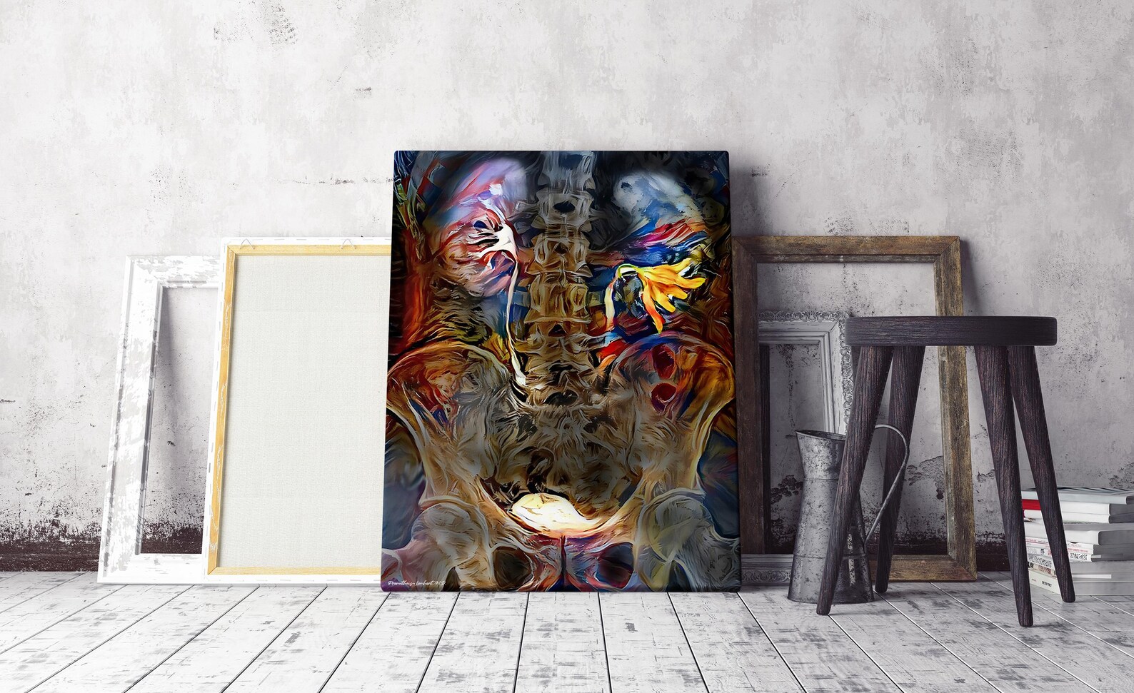 Kidney Anatomy With Drooping Lilly, Canvas, Anatomy Radiology Urology ...
