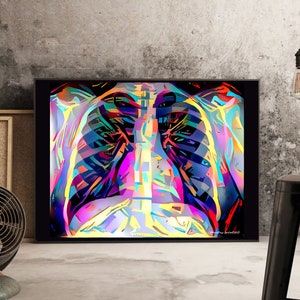 Chest Anatomy in Pop Art, Canvas, Anatomy Art, Radiology Wall Art ...