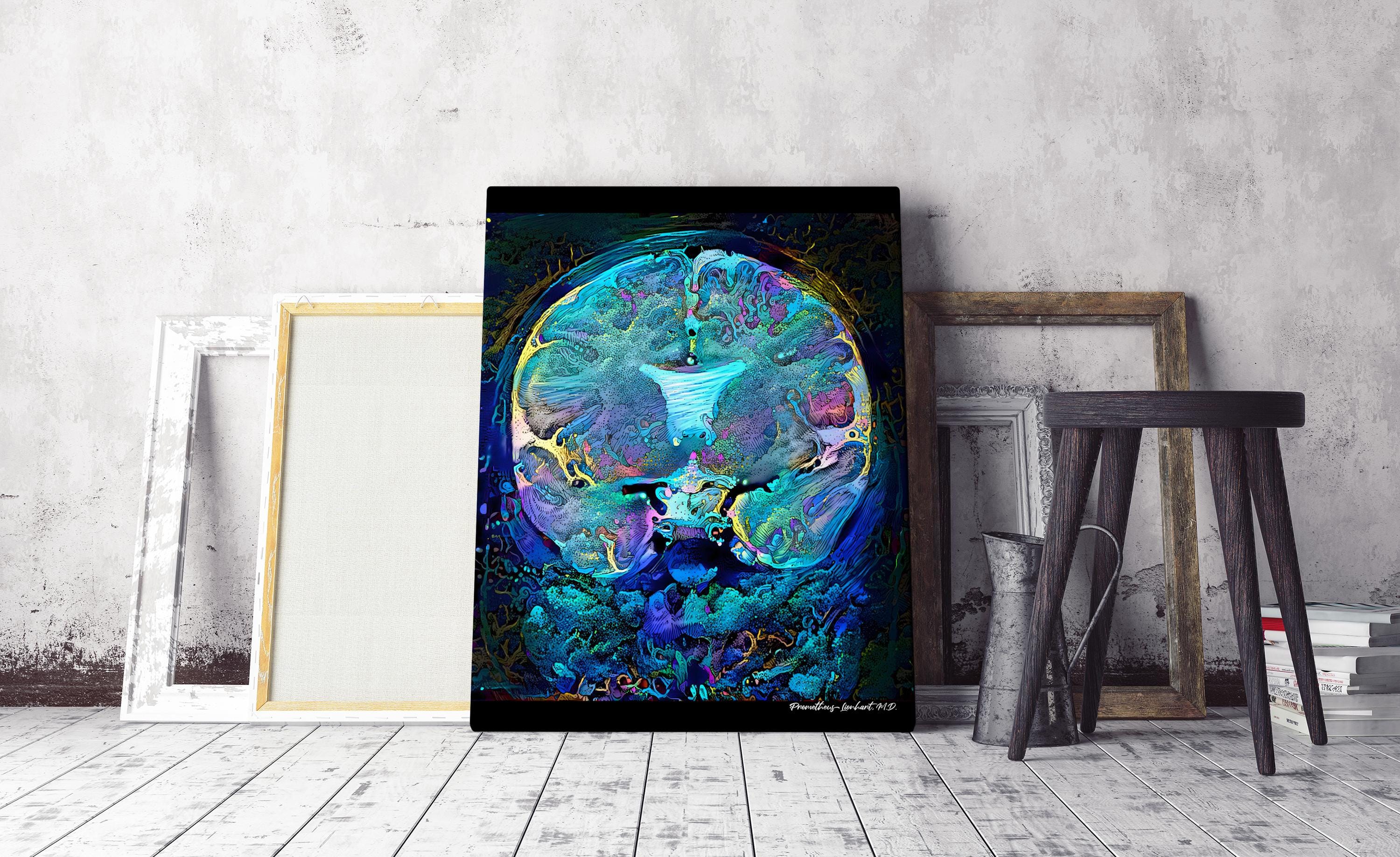 Brain Anatomy Art, Ready to Hang Canvas, Radiology Wall Art Science ...