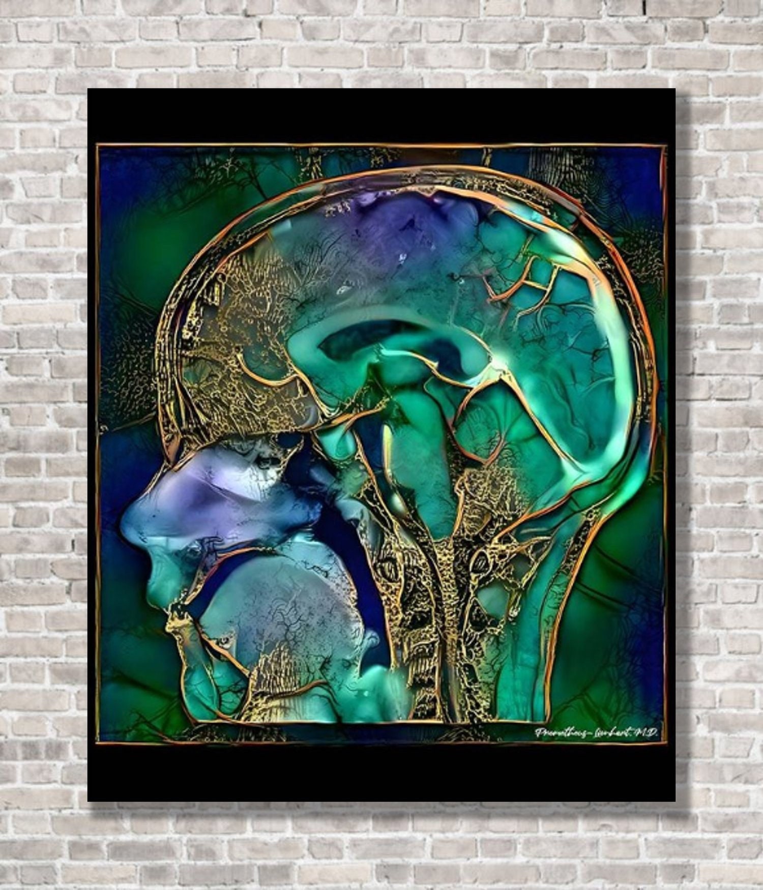 Brain Anatomy in Bright Green Color Ready to Hang Canvas - Etsy