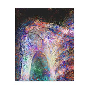 Shoulder Anatomy in Bright Color - Ready to Hang Canvas - Anatomy ...
