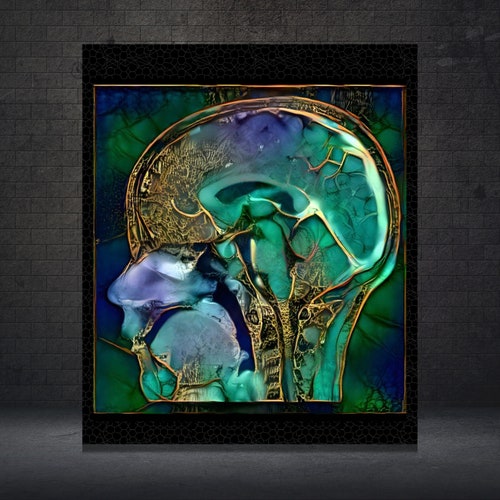 Brain Anatomy Art Ready to Hang Canvas Radiology Wall Art - Etsy