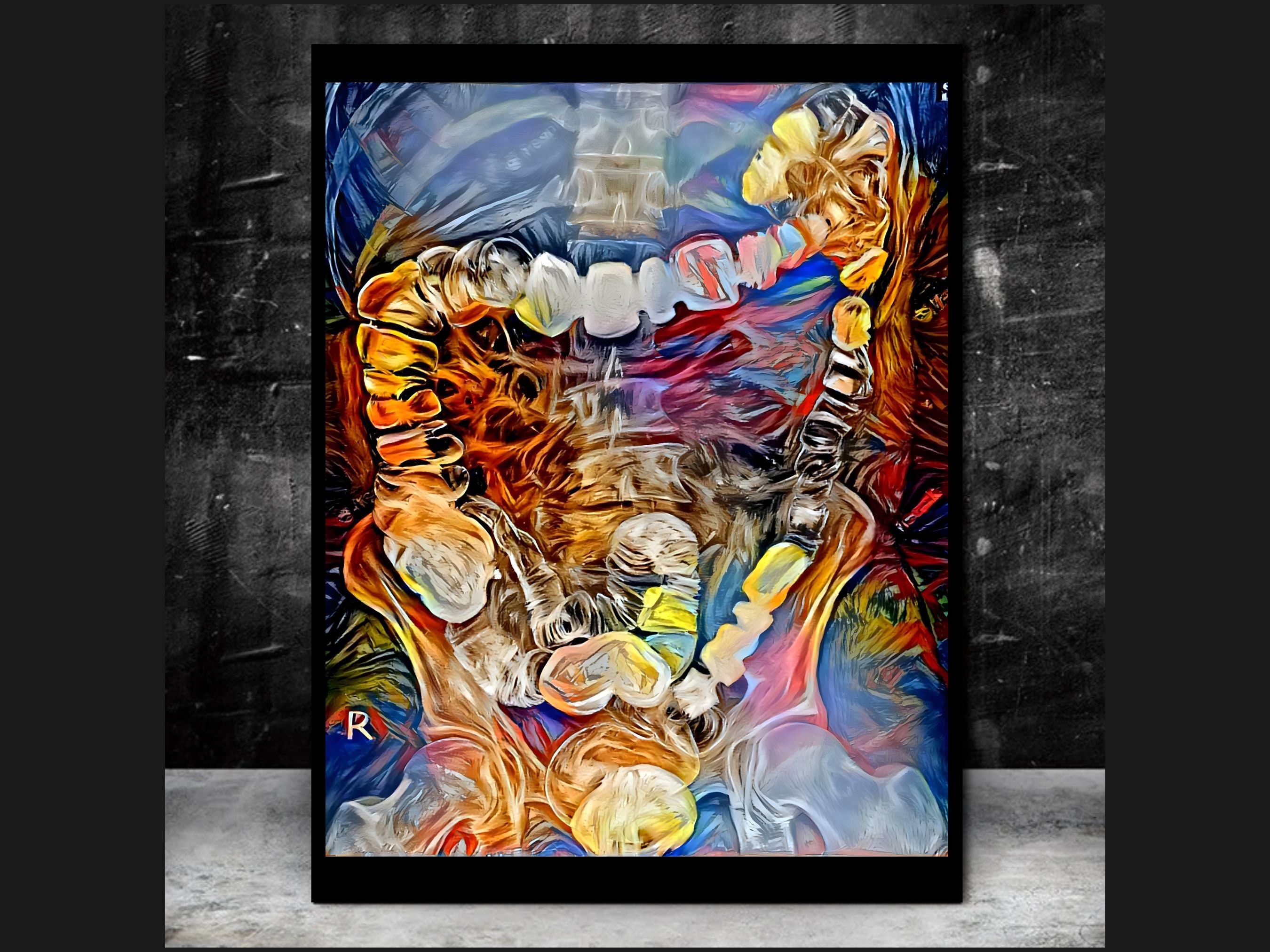 Gastrointestinal Anatomy Canvas GI Radiology Wall Art - Etsy