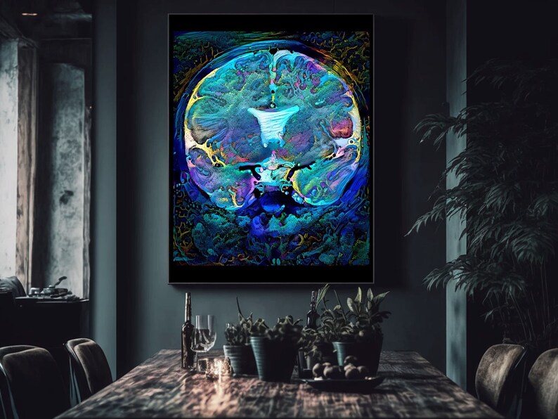 Brain Anatomy Art Ready to Hang Canvas Radiology Wall Art - Etsy