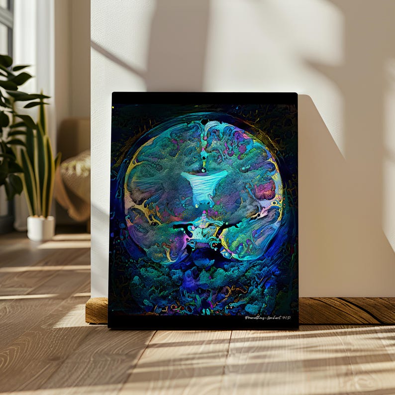 Brain Anatomy Art, Ready to Hang Canvas, Radiology Wall Art Science ...