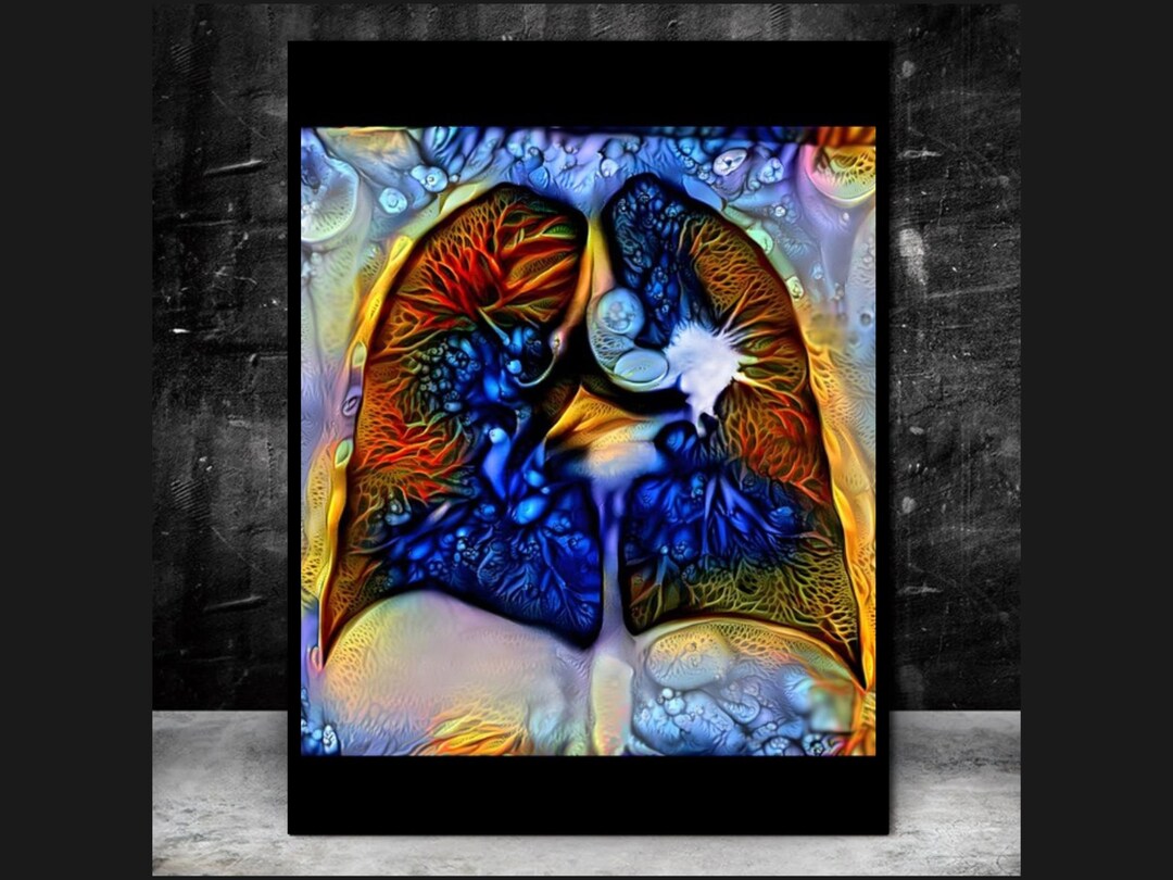 Chest Lung Anatomy in Bright Color, Canvas, Anatomy Art, Radiology Art ...