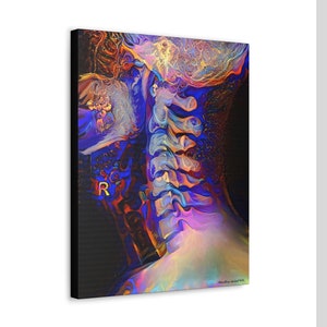 Neck and Brain Anatomy, Canvas, Poster, or Acrylic - ENT Neurosurgery ...