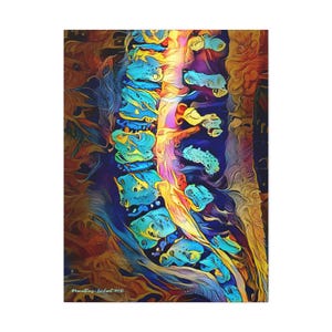 Spine Anatomy Canvas, Poster, or Acrylic Glass, Wall Art for Spine ...