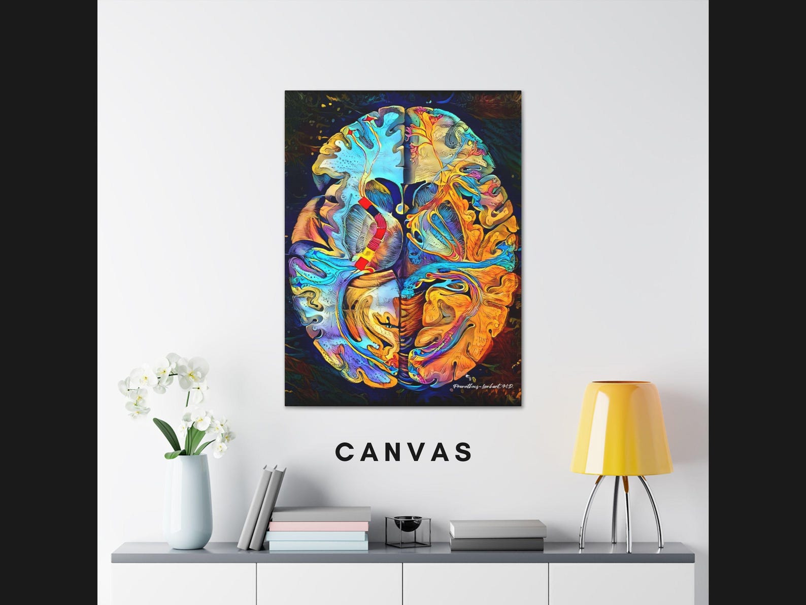 Brain Anatomy Art, Canvas or Acrylic, “alba Materia Cerebri” Doctors ...