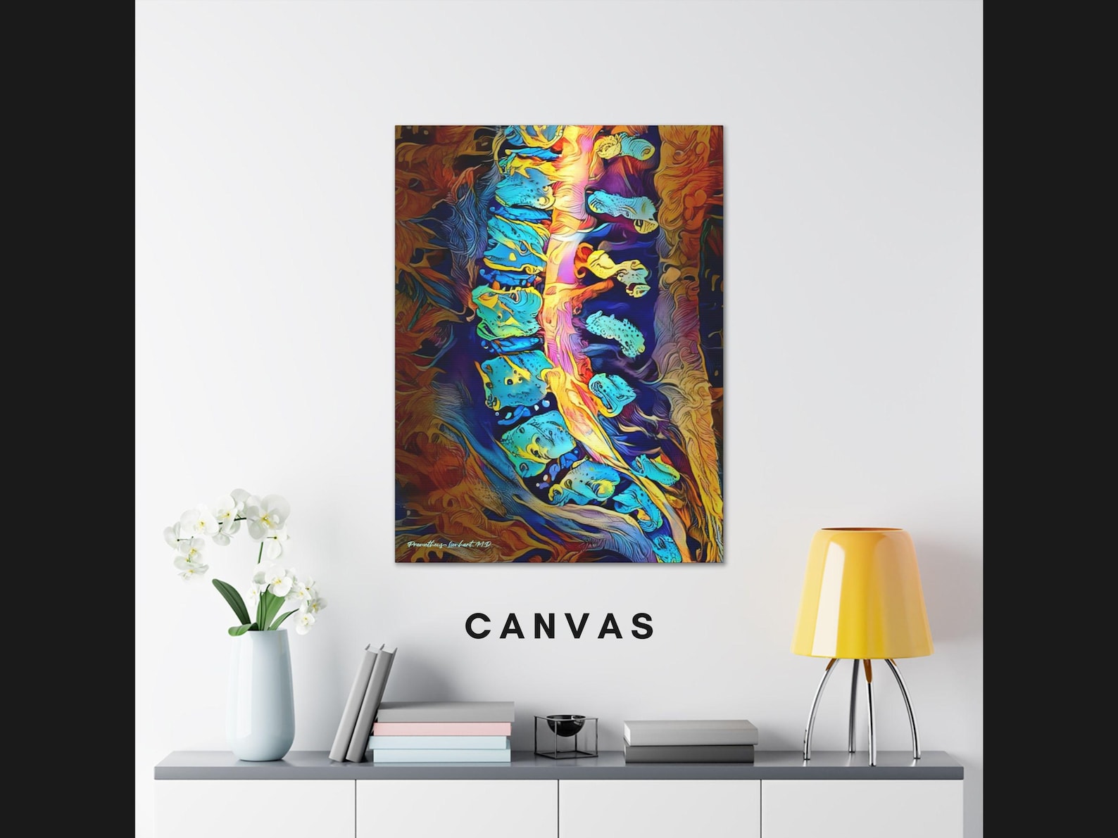 Spine Anatomy Canvas, Poster, or Acrylic Glass, Wall Art for Spine ...