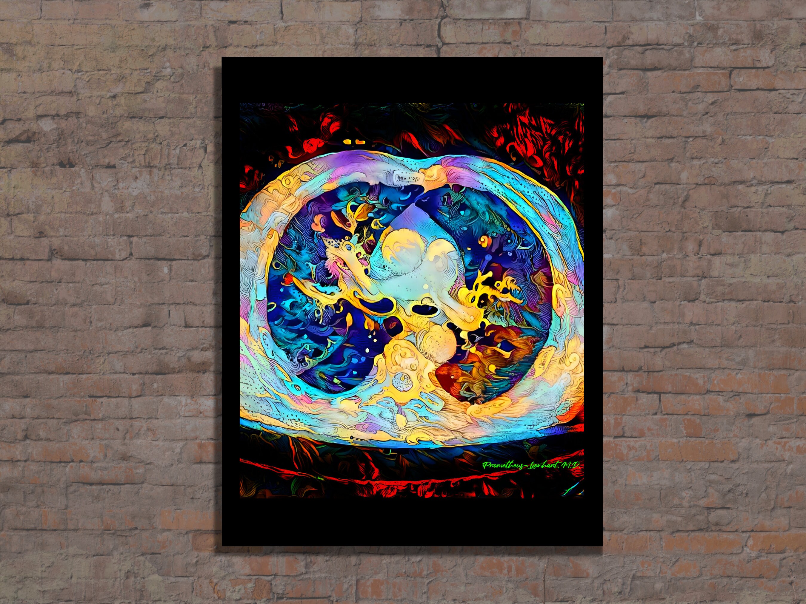 Chest Lung Pulmonary Anatomy Canvas Radiology Art Science - Etsy