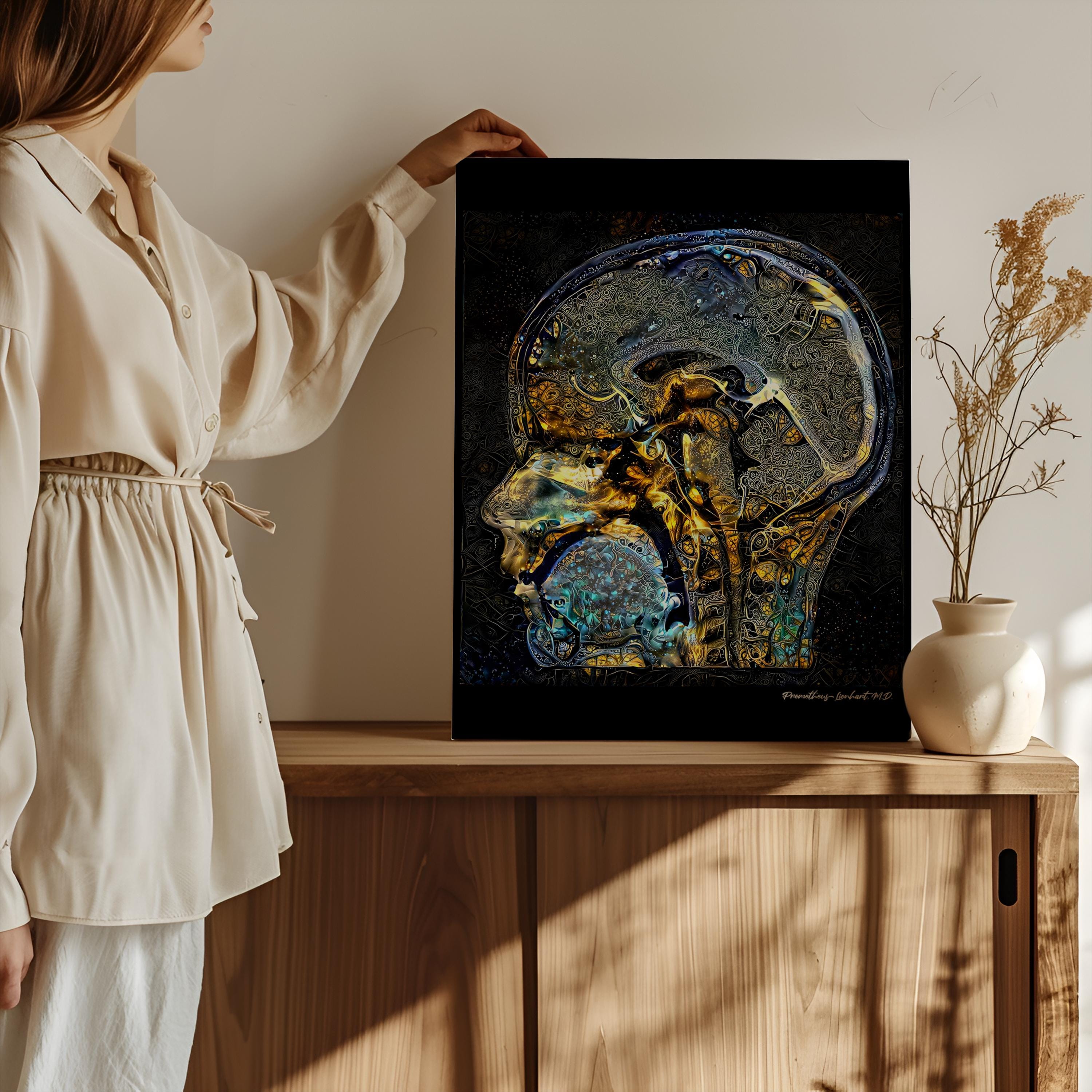 Brain Anatomy Art - Ready to Hang Canvas, Radiology Wall Decor, Medical ...