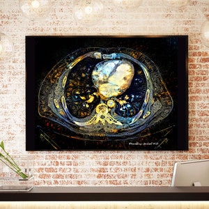 Chest Lung Pulmonary Art, Canvas, Anatomy Radiology Art Science Medical ...