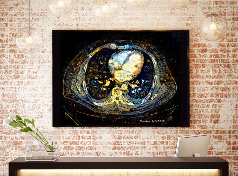 Chest Lung Pulmonary Art Canvas Anatomy Radiology Art - Etsy