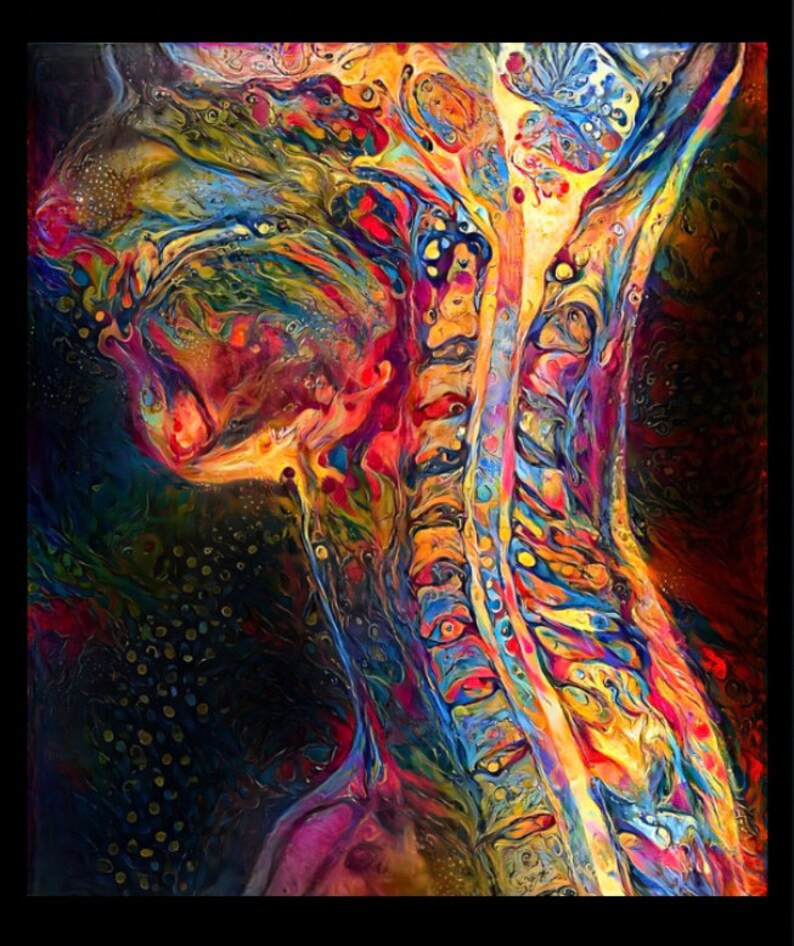 Neck and Brain Anatomy Canvas ENT Neurosurgery Radiology - Etsy