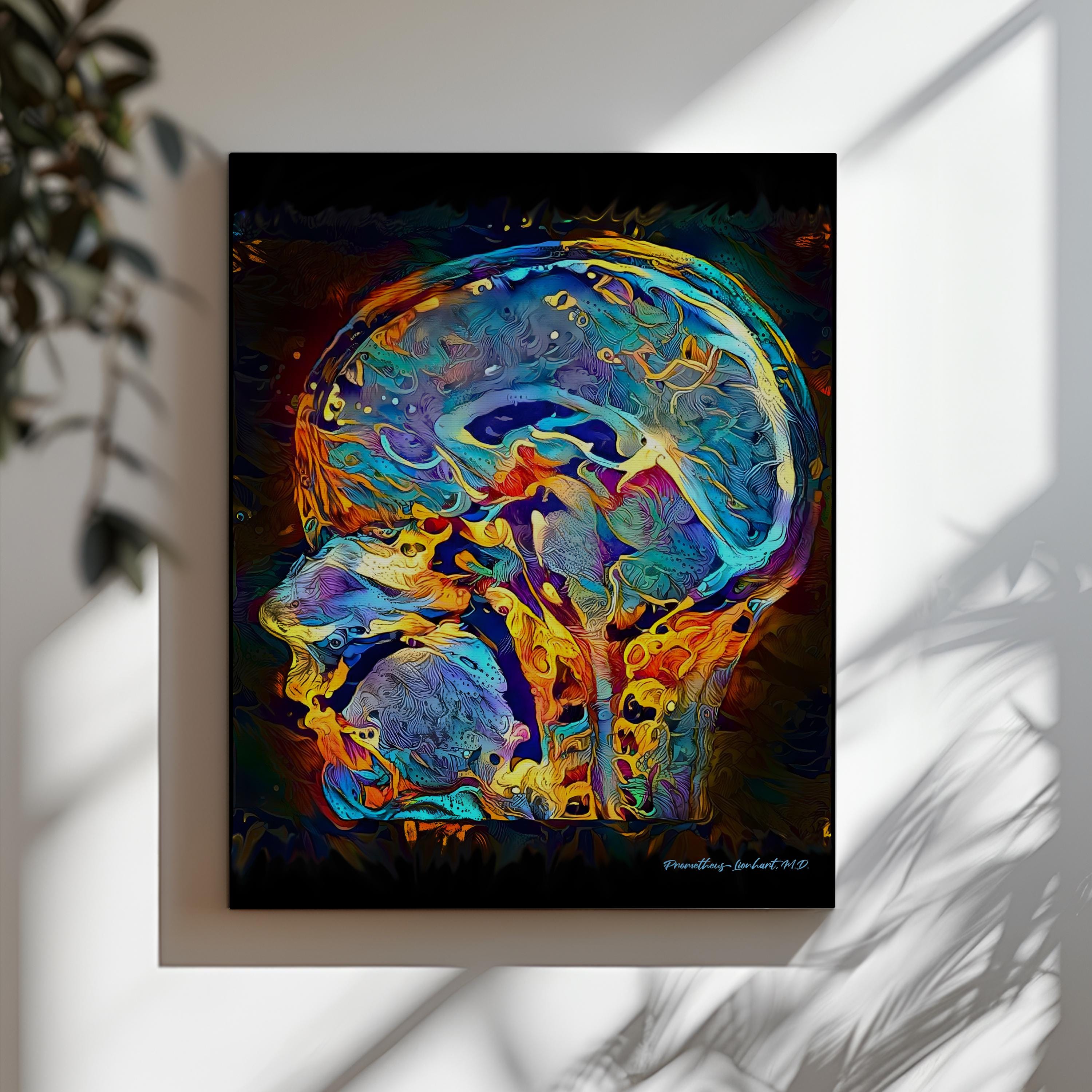 Brain Anatomy Ocean Version, Ready to Hang Canvas, Radiology Wall Art ...