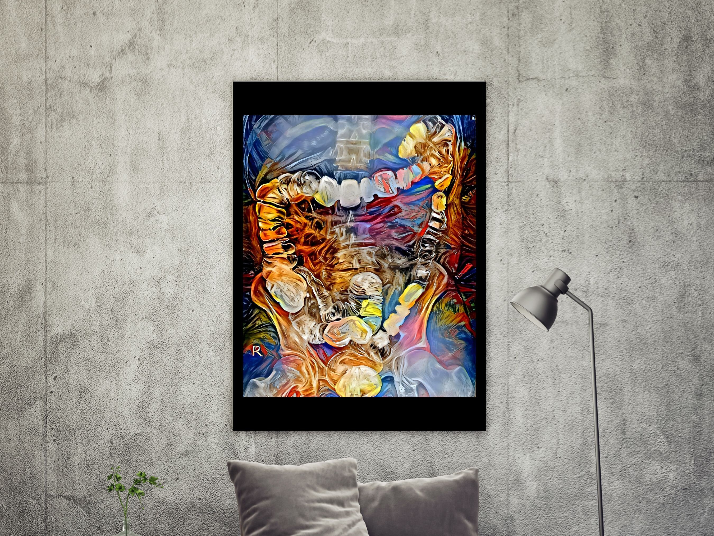 Gastrointestinal Anatomy Canvas GI Radiology Wall Art - Etsy