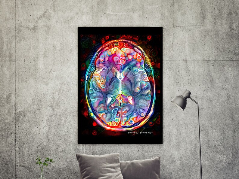 Brain Anatomy Art Canvas Rainbow Axial Radiology Wall Art - Etsy