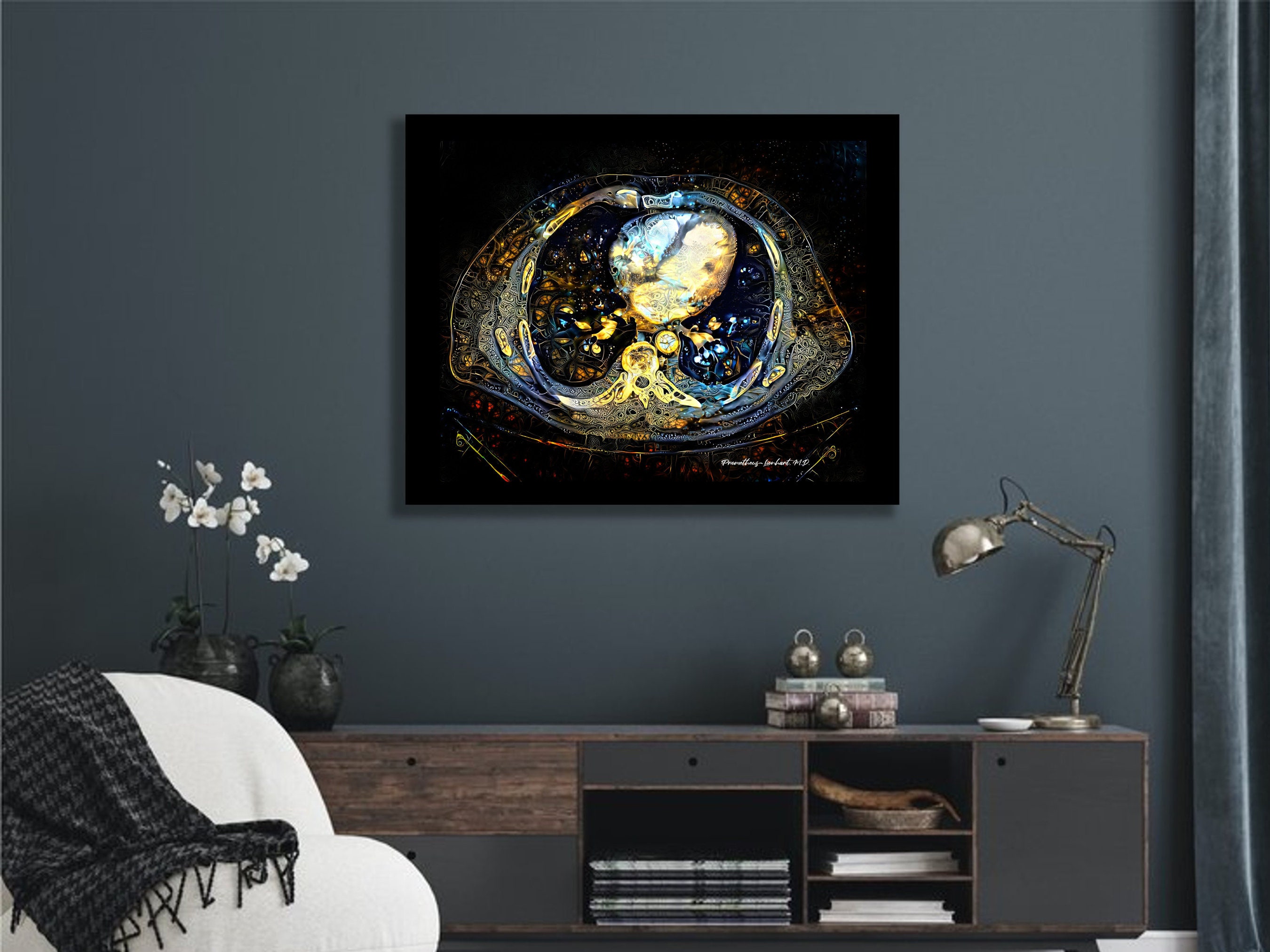 Chest Lung Pulmonary Art Canvas Anatomy Radiology Art - Etsy