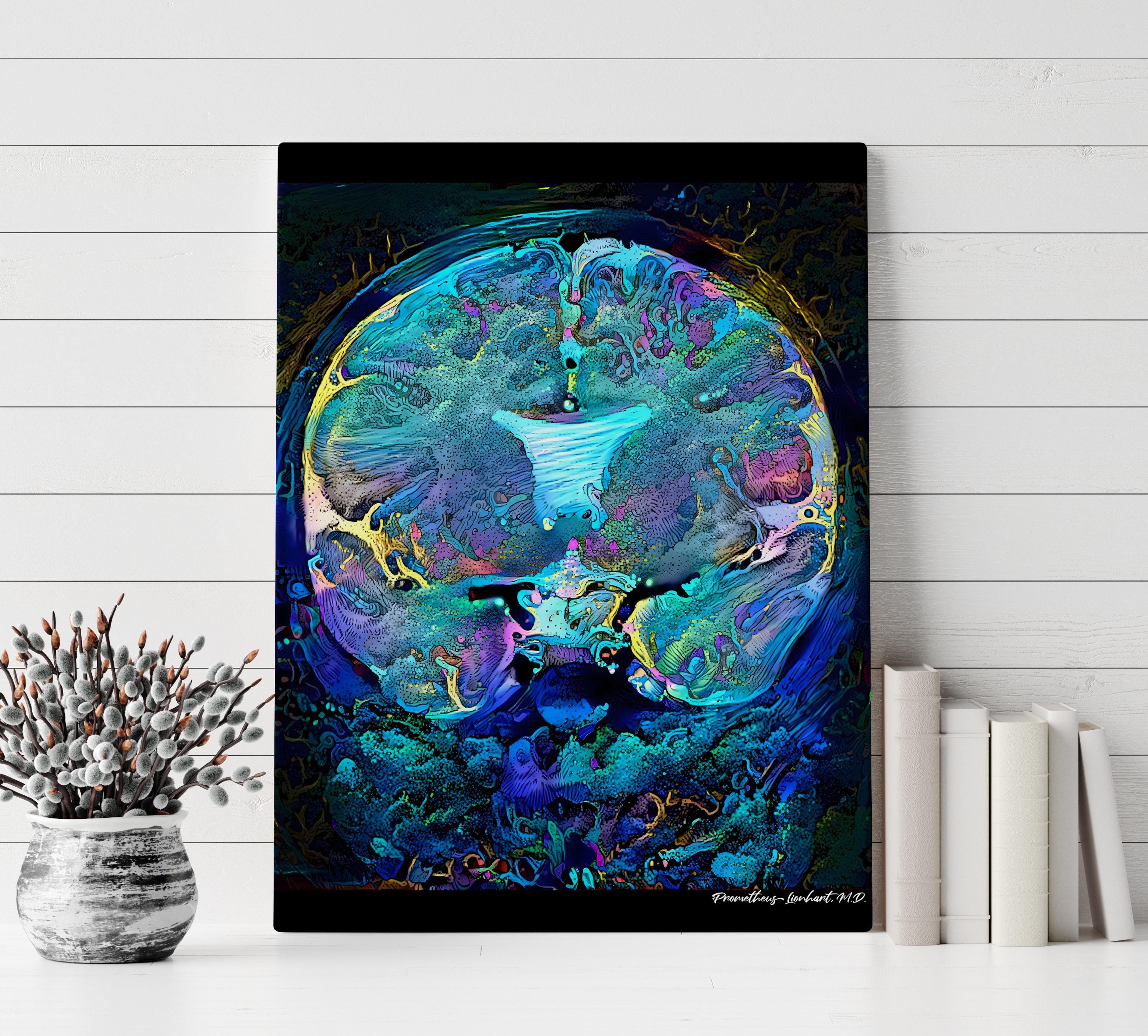 Brain Anatomy Art, Ready to Hang Canvas, Radiology Wall Art Science ...