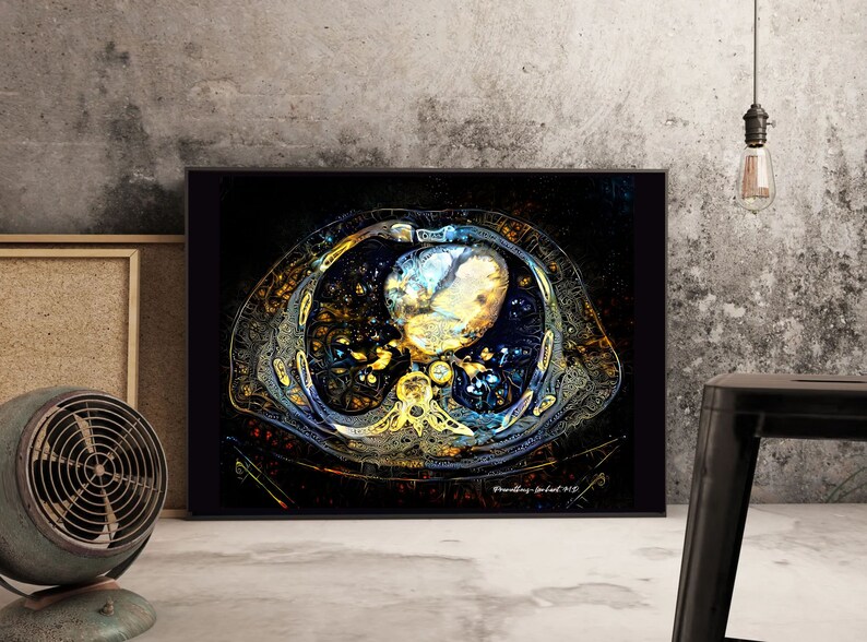 Chest Lung Pulmonary Art Canvas Anatomy Radiology Art - Etsy