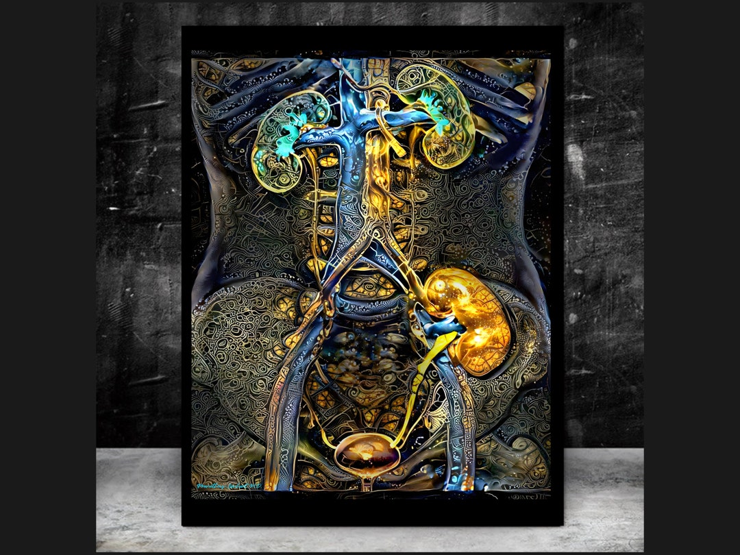 Renal Transplant Art, Kidney Transplant Art, Ready to Hang Canvas ...