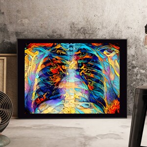 Chest Anatomy in Bright Color, Canvas, Anatomy Art, Radiology Wall Art ...